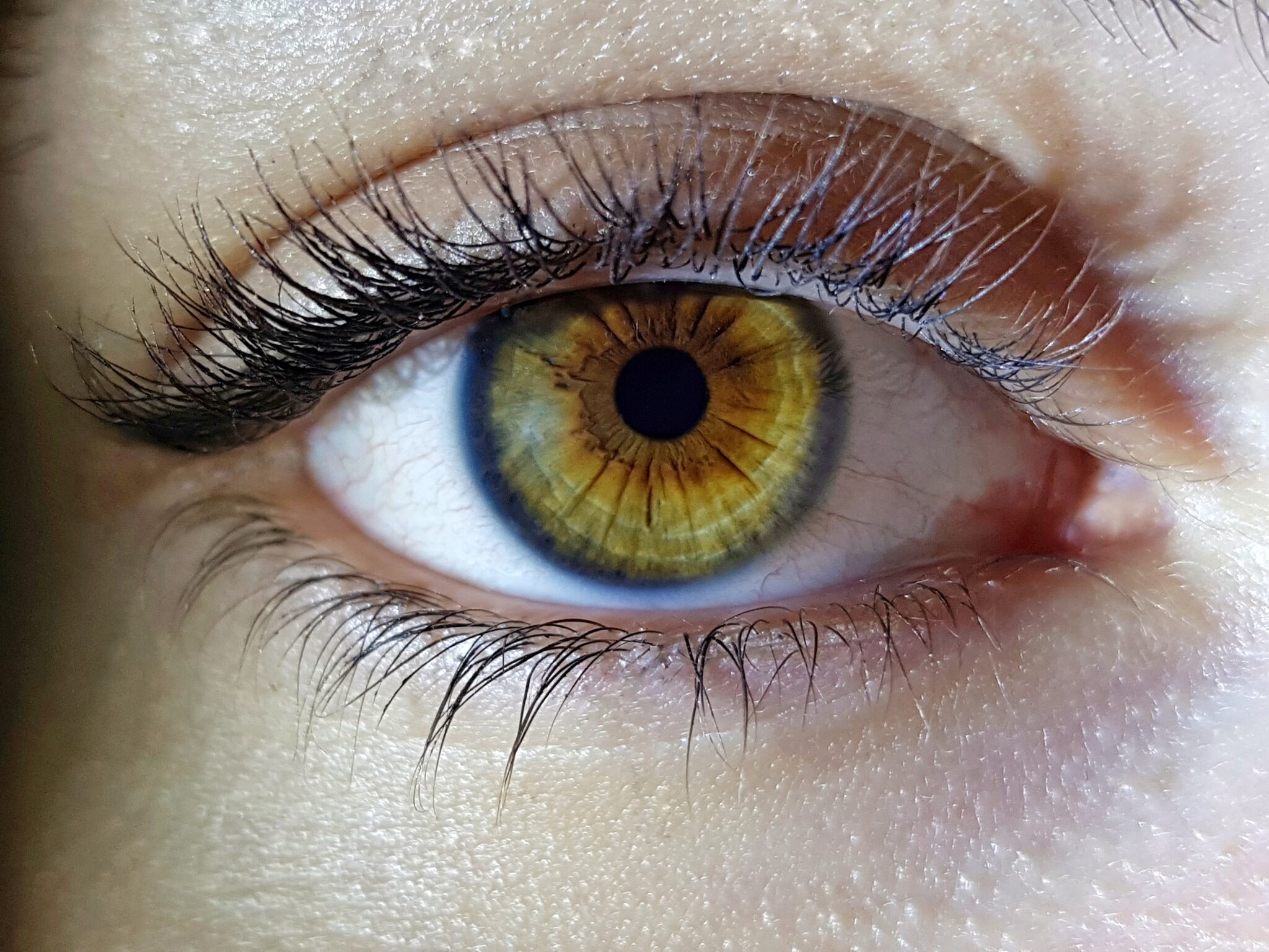 Pathologies de la Rétine et de l'Œil | Paris Rétina Vision